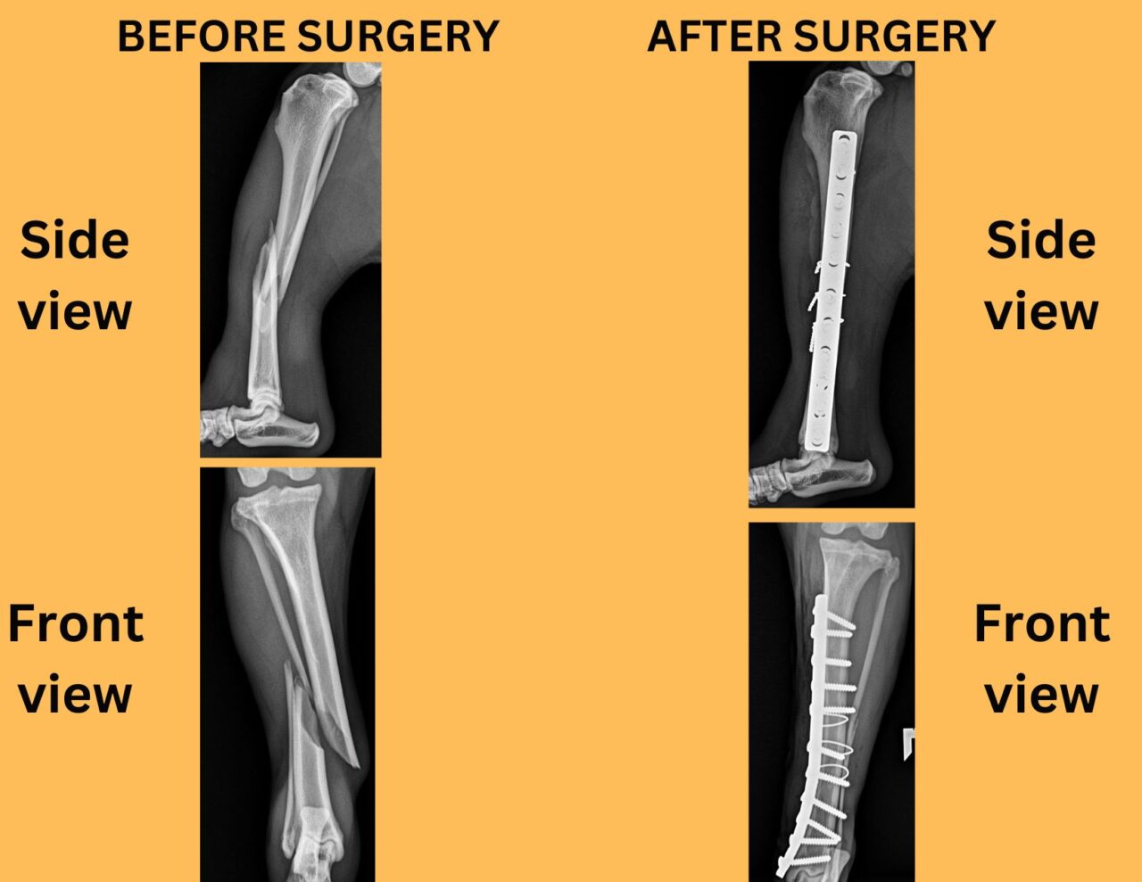 What Were Our Most Common Surgeries In 2025? - Lehigh Regional ...