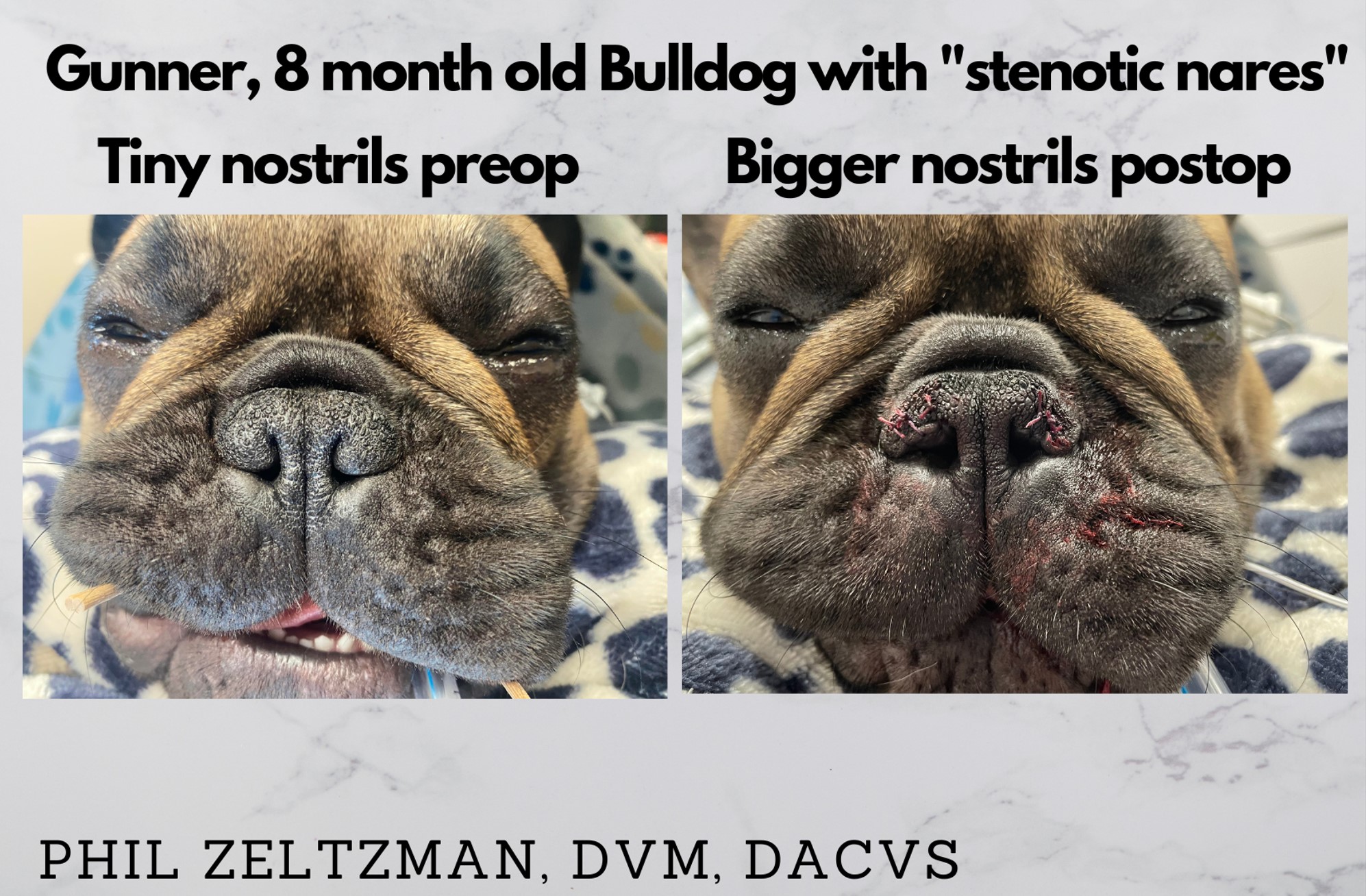 What Were Our Most Common Surgeries In 2025? - Lehigh Regional ...